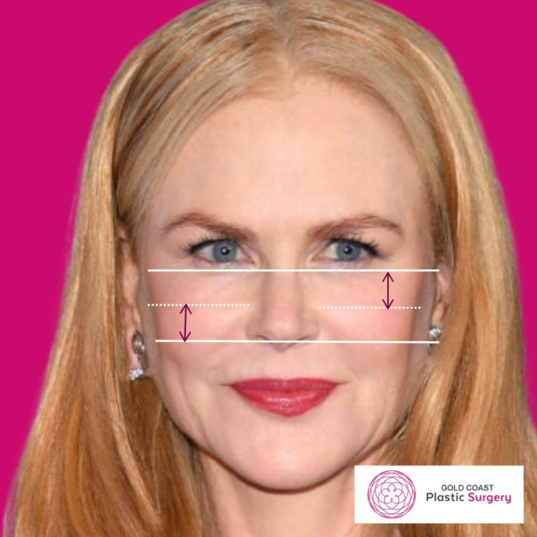 High vs Low Cheekbones: How do you know?