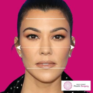 High vs Low Cheekbones: How do you know?